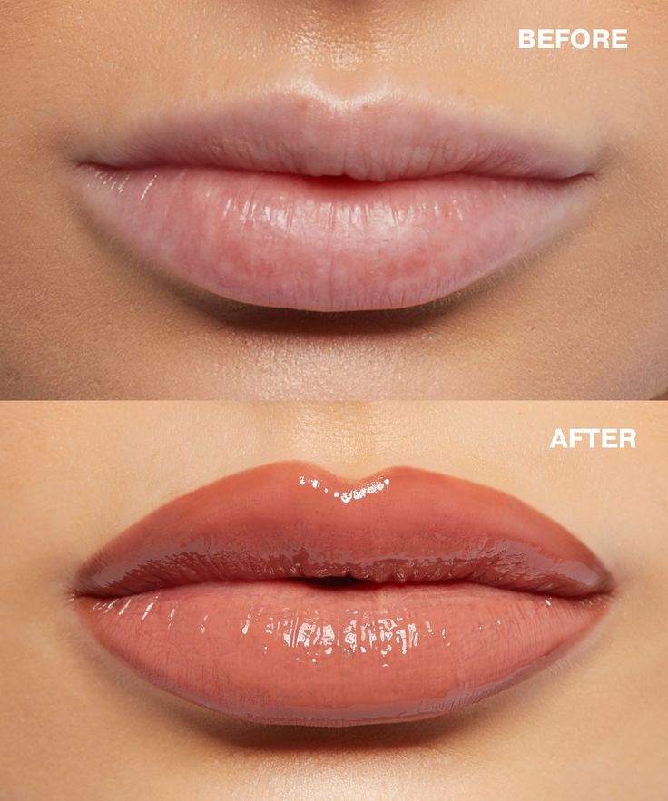 VT - Reedle Shot Lip Plumper – Vityne